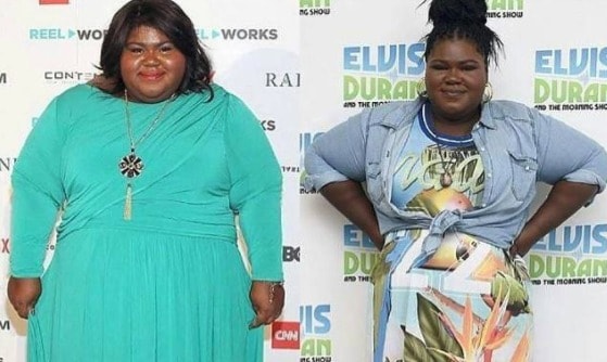 20 Celebrities Who Have Had Weight Loss Surgery
